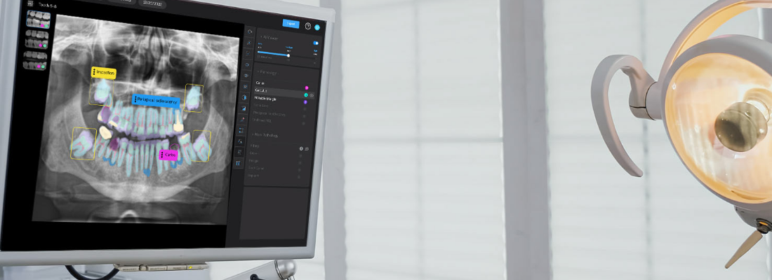 Exploring the Cutting-Edge Technology in Modern Dental Offices
